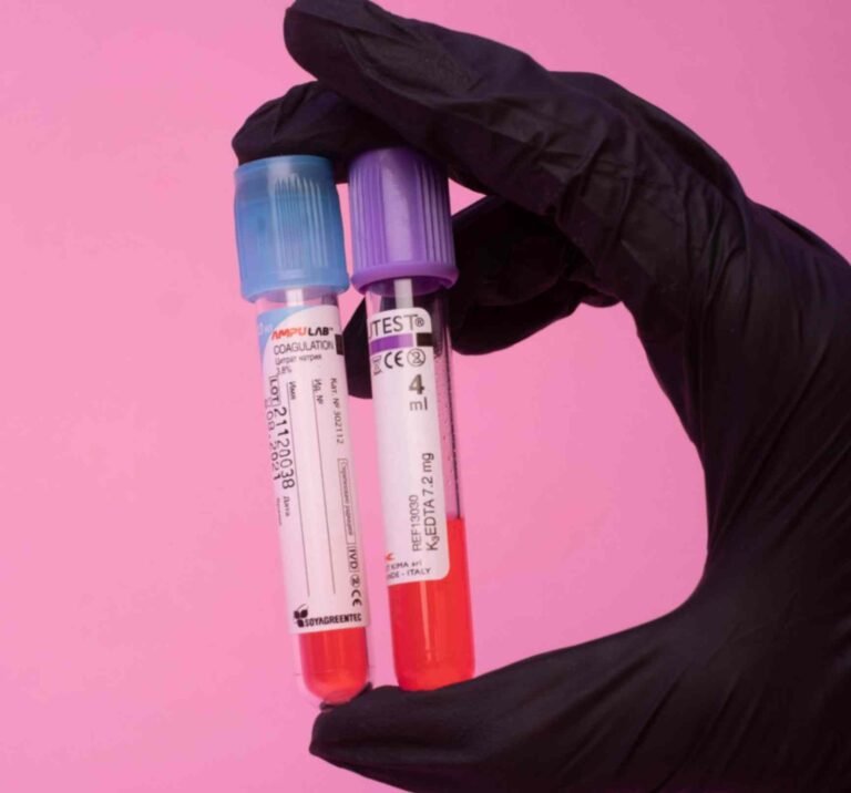 Estimation Of Hemoglobin By Sahli's Method
