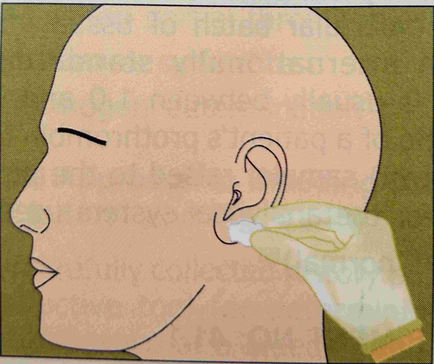 Bleeding Time Test Requirement,principle And Procedure