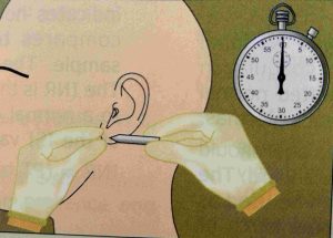 Bleeding Time Test Requirement,principle And Procedure