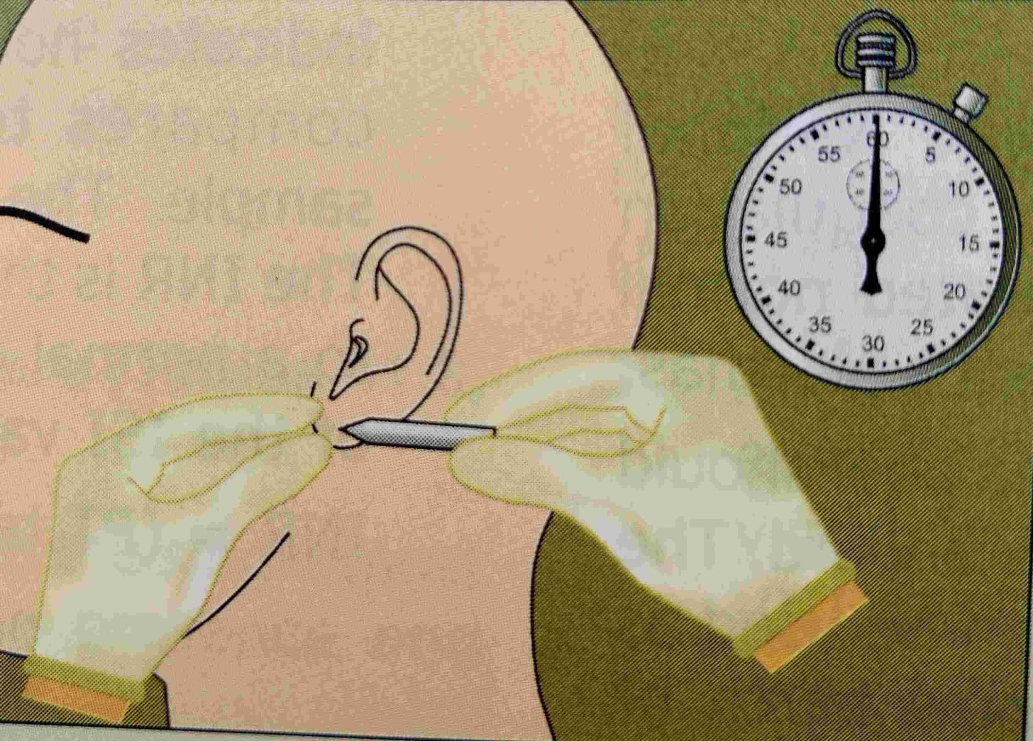 Bleeding Time Test Requirement,principle And Procedure