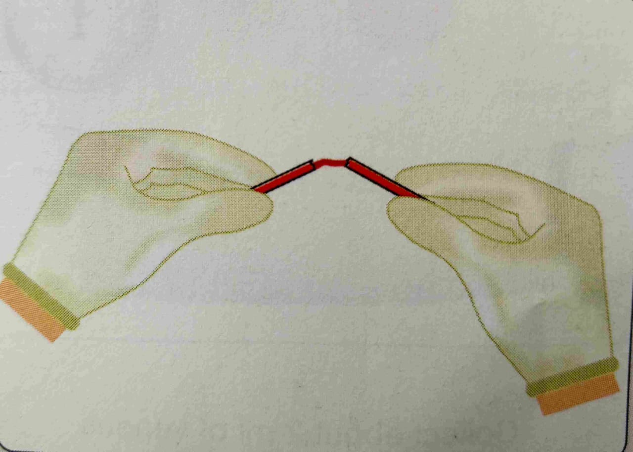 CLOTTING TIME TEST PRINCIPLE,PROCEDURE BY CAPILLARY METHOD