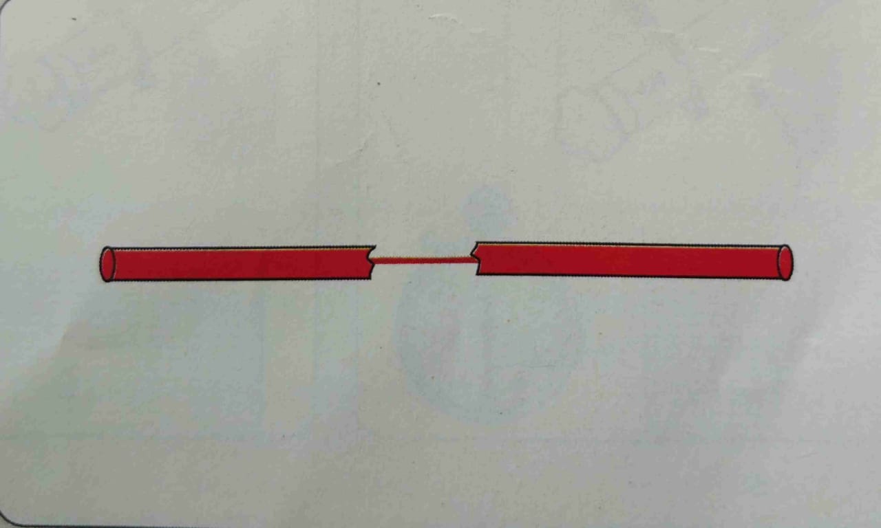 CLOTTING TIME TEST PRINCIPLE,PROCEDURE BY CAPILLARY METHOD