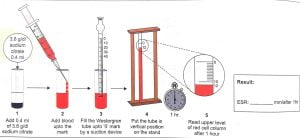 Bleeding Time Test Requirement,principle And Procedure